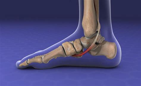Tibialis Posterior Dysfunction Watsonia Podiatry