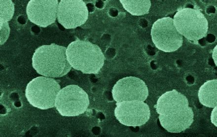 Pediococcus Acidilactici Alchetron The Free Social Encyclopedia