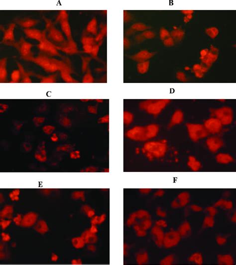 Mda Mb 231 Cells Undergoing Nuclear Condensation Chromatin Download Scientific Diagram