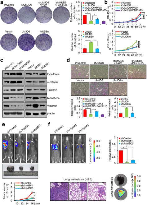 Jmjd6 Promotes The Proliferation And Invasion Of Melanoma Cells In