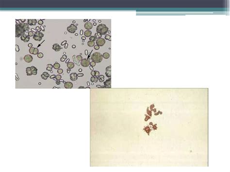 Шээсний тундасын шинжилгээ Pptx