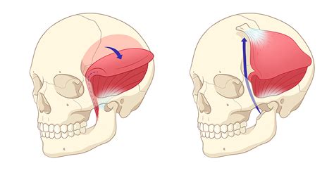 Split Temporal Muscle Pedicled Flap On Behance
