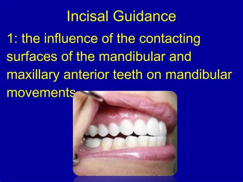 9 Anterior Teeth Arrangement Ppt