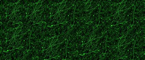 Axonal Branching Jin Moo Lee Research Washington University In St