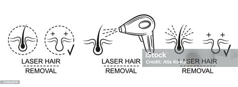 레이저 머리 전구 제거 여자 피부 제모 아름다움 절차 라인 아이콘 탈모 Ipl 빔 제모기 바디 케어 위생 열광선 성장을 멈추고 여포를 제거하십시오 미용 치료 벡터