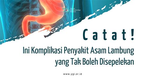 Videoygi Catat Ini Komplikasi Penyakit Asam Lambung Yang Tak Boleh