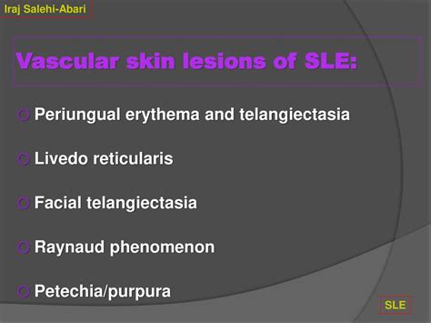 “systemic Lupus Erythematosus” Other Clinical Features Ppt Download