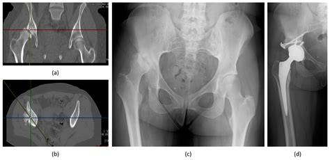 Biomedicines Free Full Text Investigating And Practicing Orthopedics At The Intersection Of