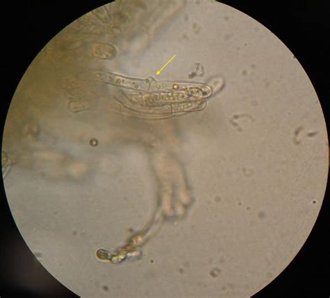 Myfa 6 The Sex Life Of Mushrooms — Future Ecologies Podcast
