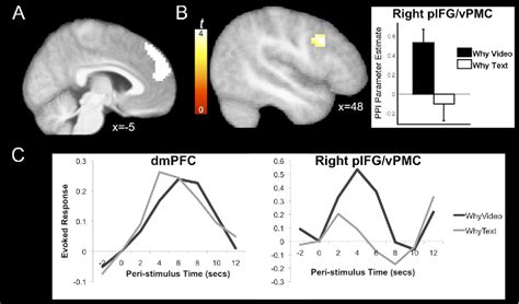 Figure 4 From Behavioral Systems Cognitive Dissociating Modality