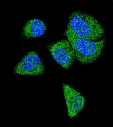 Complement C6 Antibody Pa5 72500