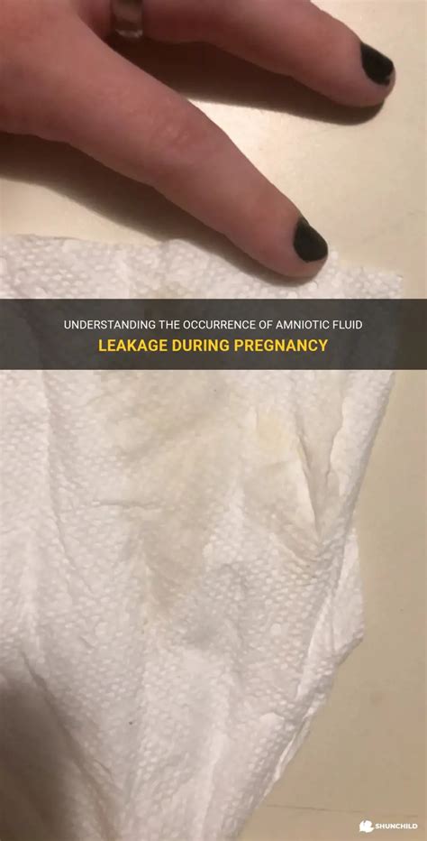 Understanding The Occurrence Of Amniotic Fluid Leakage During Pregnancy