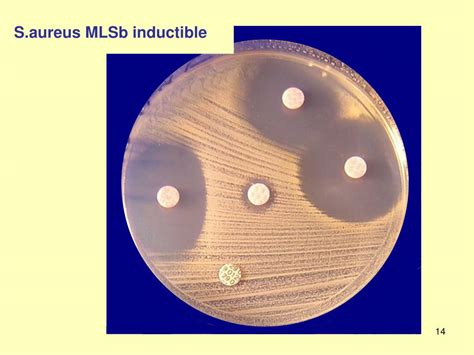 Ppt Technique Dantibiogramme Des Staphylocoques Staphylococcus Aureus Powerpoint