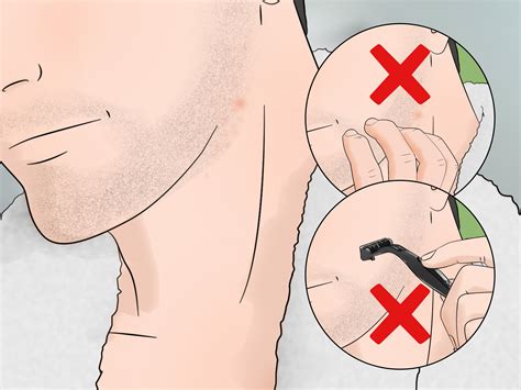 17 Ways To Stop Itching After Shaving Wikihow