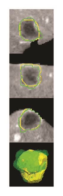 Segmentation Results Obtained By The Proposed Method Compared To Ground Download Scientific