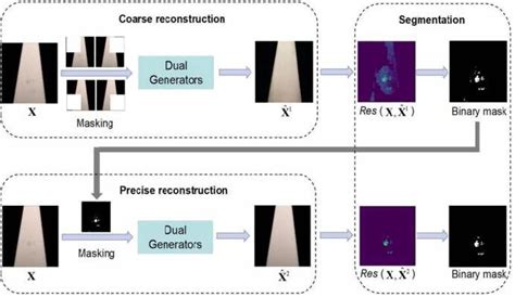 Figure 1 From Automated Anomaly Detection For Surface Defects By Dual Generative Networks With