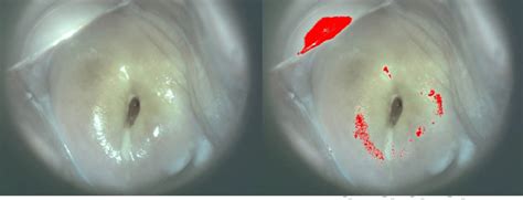 The Results Of Color Segmentation With Parameters Download Scientific Diagram