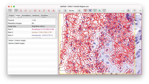 Cell Detection Using Hematoxylin Always Assumes It Is The First Stain