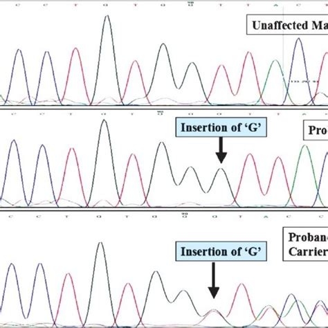 A Representative Figure Showing Mlpa Results In A Normal Control