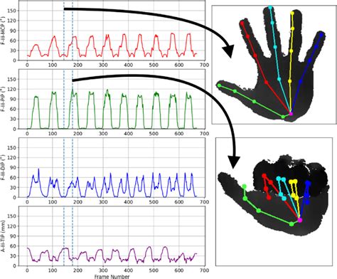 Angle Estimates And Two Correspondences To Poses Obtained By The Pose