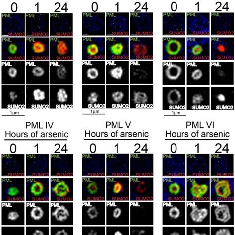 Immunofluorescence Analysis Of Pml Isoforms Following Arsenic