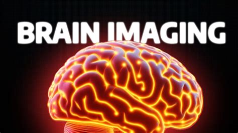 Decoding Brain Function The Neuroscience Of Fmri Youtube