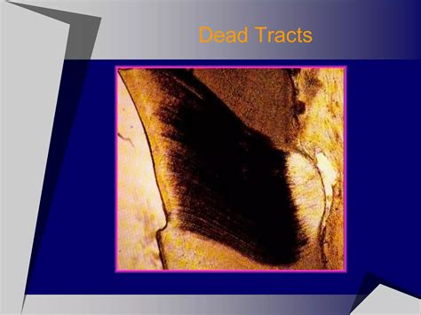 Dentinal Hypersensitivitypdf