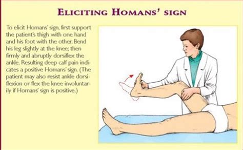 Homans Sign Signs Of Deep Vein Thrombosis Homans Sign Nursing Information Nurse