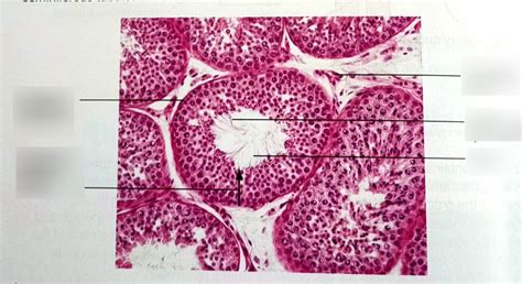 Diagram Of Ts Testis Quizlet