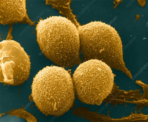 Basophil Under Microscope Granulocytes