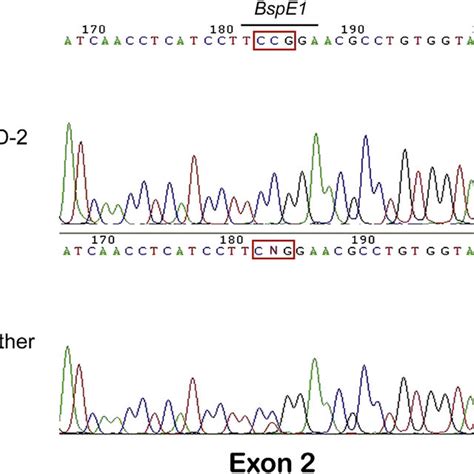 Missense Mutations Identified In Exon 9 C 1978c T And 10 C 2006a G