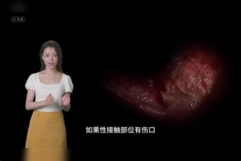 女性外阴尖锐湿疣症状图片 南京圣贝医院