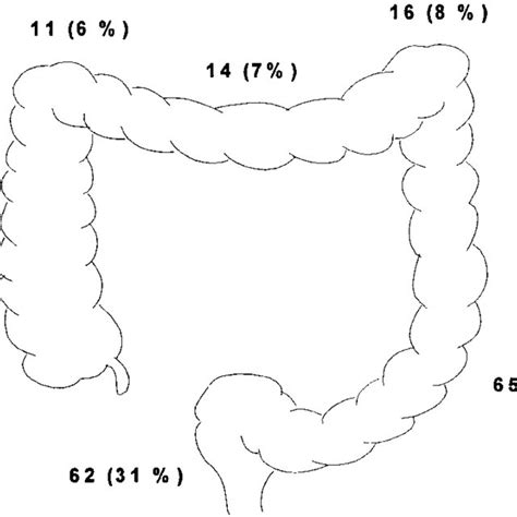 Overall Survival After Multivisceral R0 Resection Download Scientific Diagram