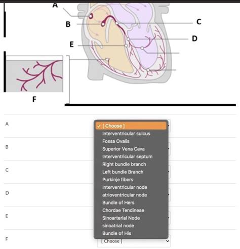 Solved Choose Interventnicular Suicus Fossa Ovalis Superior Vena Cava Interventricular Septum