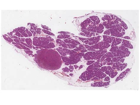 19 Heterotopia Ectopia Histopathology Atlas