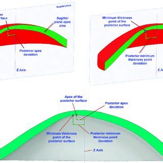 Geometric Variables Analysed During The Study Download Scientific Diagram