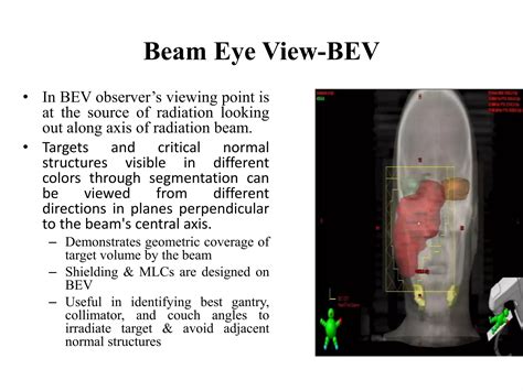 Three Dimensional Conformal Radiation Therapy Pptx 3 D Graphics Computer Software And