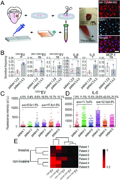 Single Cell Secretion Analysis Of Primary Tumor Cells From Oscc