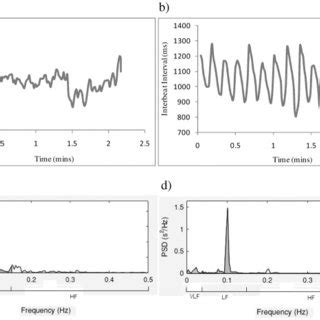 A IBI During Two Minutes Of Resting State Changes In HR Due To Download Scientific Diagram