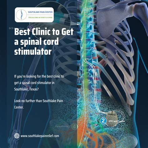 Spinal Cord Stimulator Surgery And Recovery Southlake Texas South