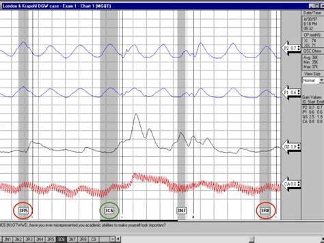 News News About Polygraphs Voice Stress Analyzers