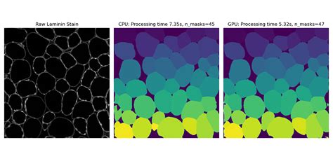 Benchmarking Cellpose On Mac Metal Gpu Image Analysis Imagesc Forum
