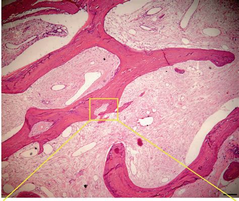 He Staining Shows The Trabecular Structure And Osteocyte Lacunae Of The