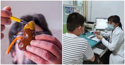 Ngh Con D Y Th S M M A I Kh M R I S C N Ng Khi Bs N I Kh Ng Th C U V N N A R I