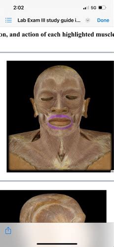 Lab Exam III Flashcards Quizlet