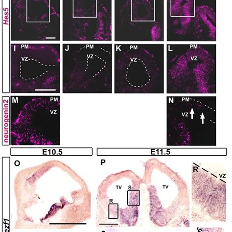 Fezf1 And Fezf2 Repress Hes5 Promoter Activity A Schematic Drawing Download Scientific