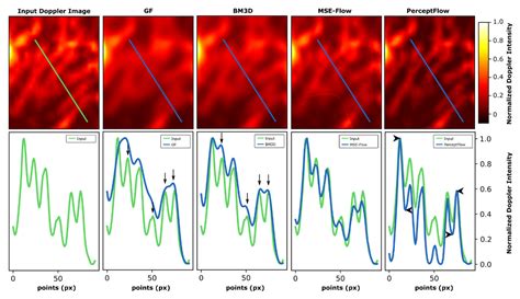 Perceptflow Real Time Ultrafast Doppler Image Enhancement Using Cnns And Perceptual Loss Myriad