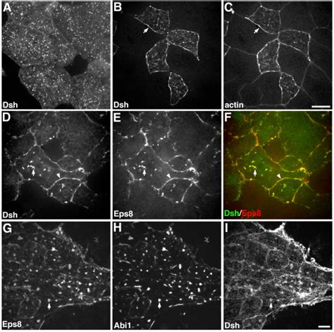 Regulation Of Actin Cytoskeleton Architecture By Eps8 And Abi1 Pmc