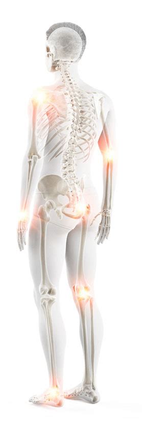 Statin Intolerance Muscle Symptoms LearnYourLipids