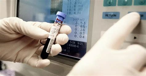 Understanding Chronic Myelomonocytic Leukemia Insights And